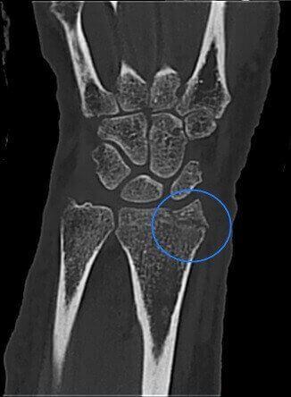 CBCT Imaging 3D 5G XL Device | Newtom Medical