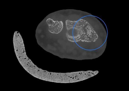 CBCT Imaging 3D 5G XL Device | Newtom Medical