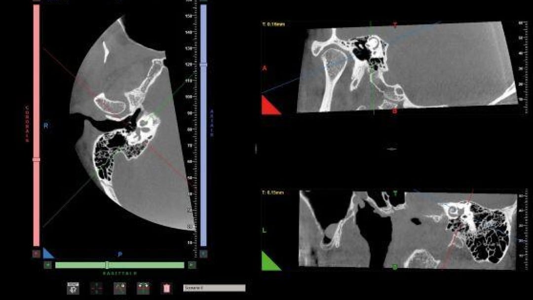 NNT NewTom: Efficient Image Management